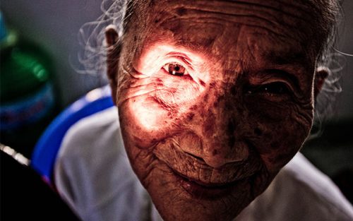 Pioneering Optometry in Vietnam - Optometry Giving Sight